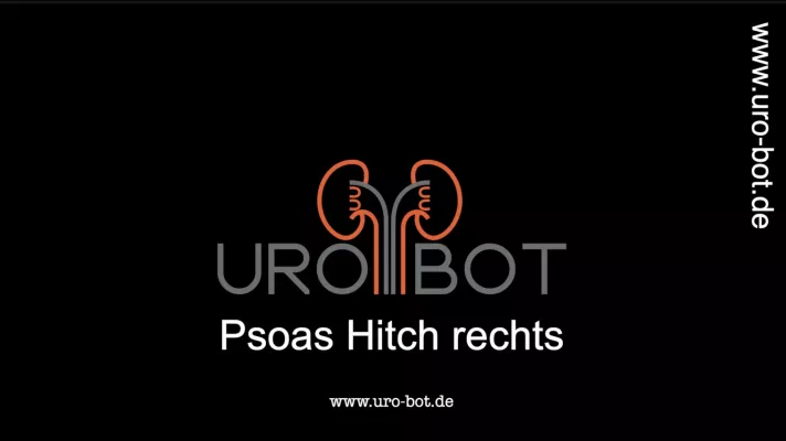 Harnleiterneuimplantation mit Psoas Hitch/Boari Flap